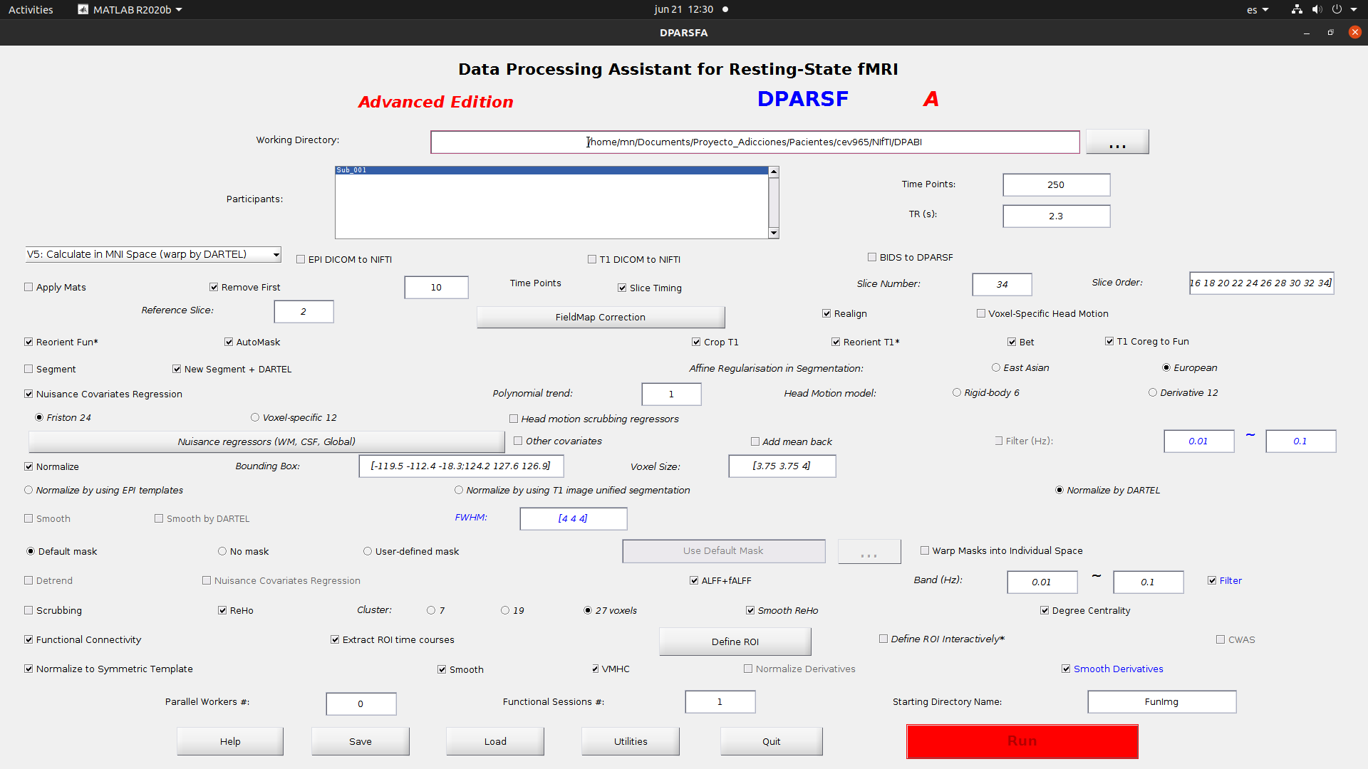 DPABI/DPARSF/VMHC error | The R-fMRI Network